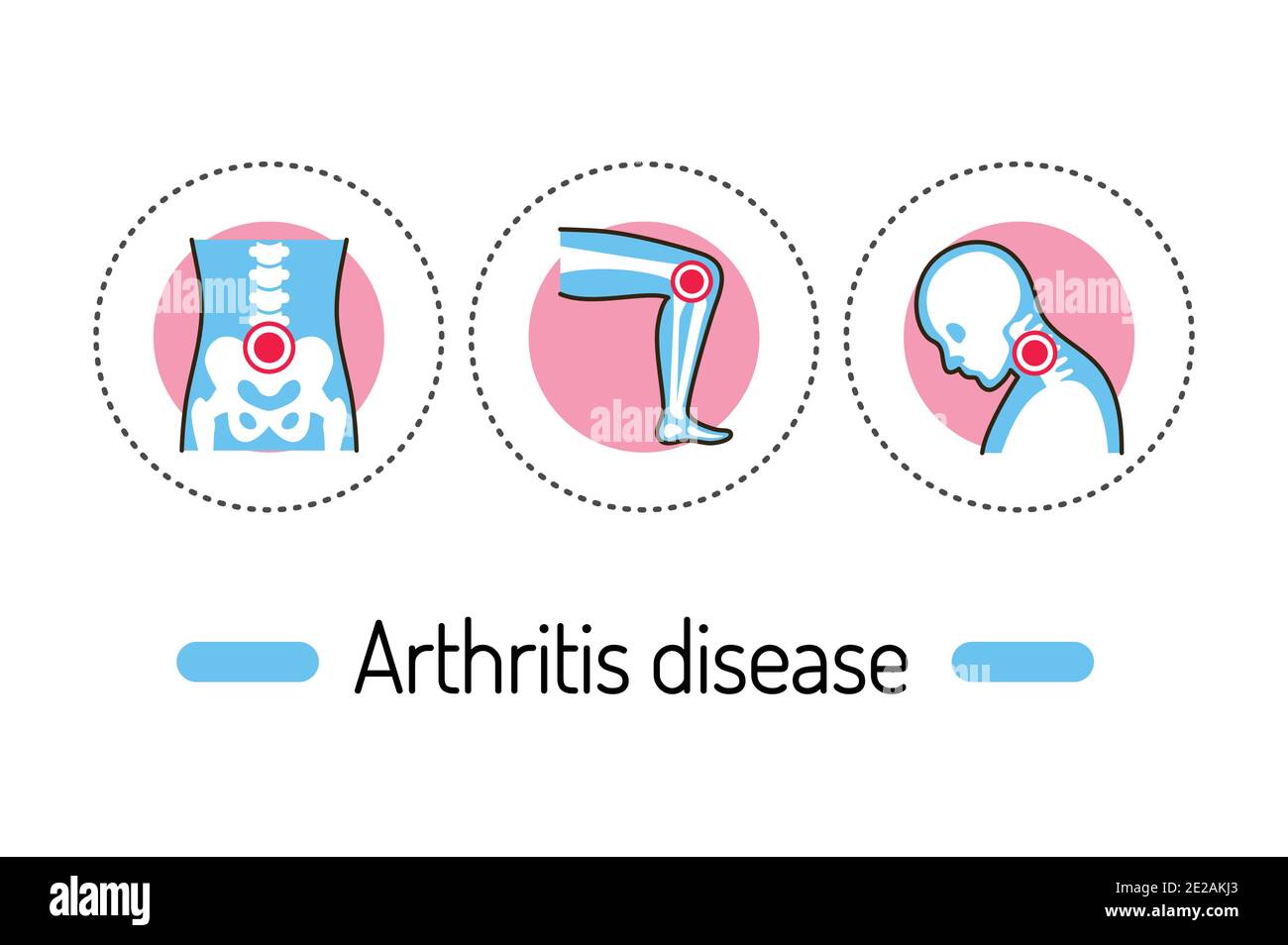 Arthritis disease outline concept. Inflammation joints line color icons ...