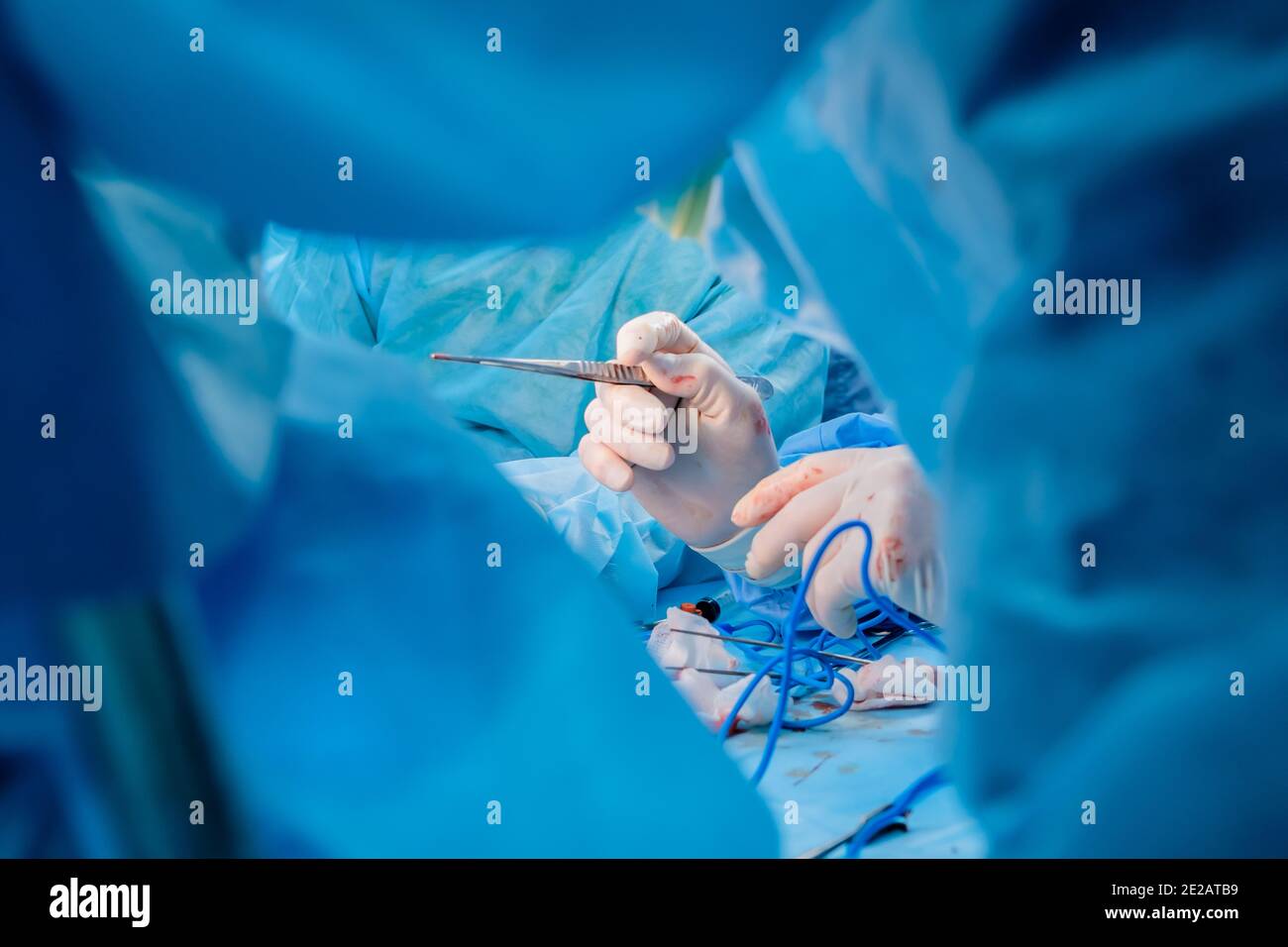 Bloodied surgeon's hands in sterile latex gloves holding surgical ...