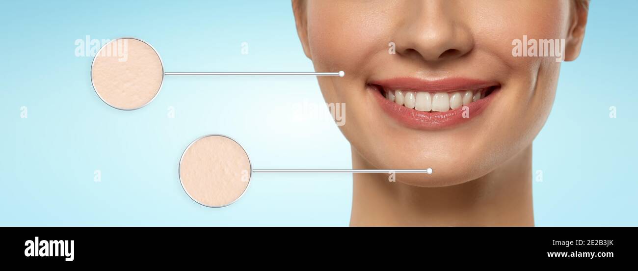 woman face with pointers showing zoomed skin area Stock Photo - Alamy