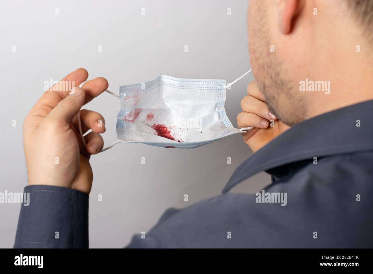 A male patient holds a medical mask with traces of blood. Lung cancer ...