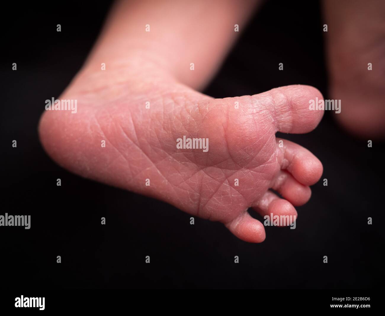African baby feet hi-res stock photography and images - Alamy