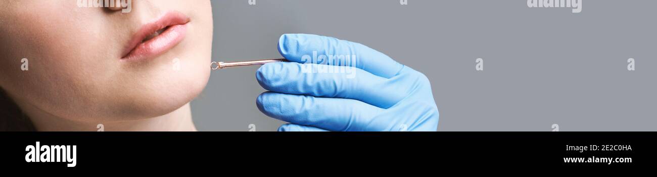 Loop device for medical design. Woman skin procedure. Natural cosmetic ...