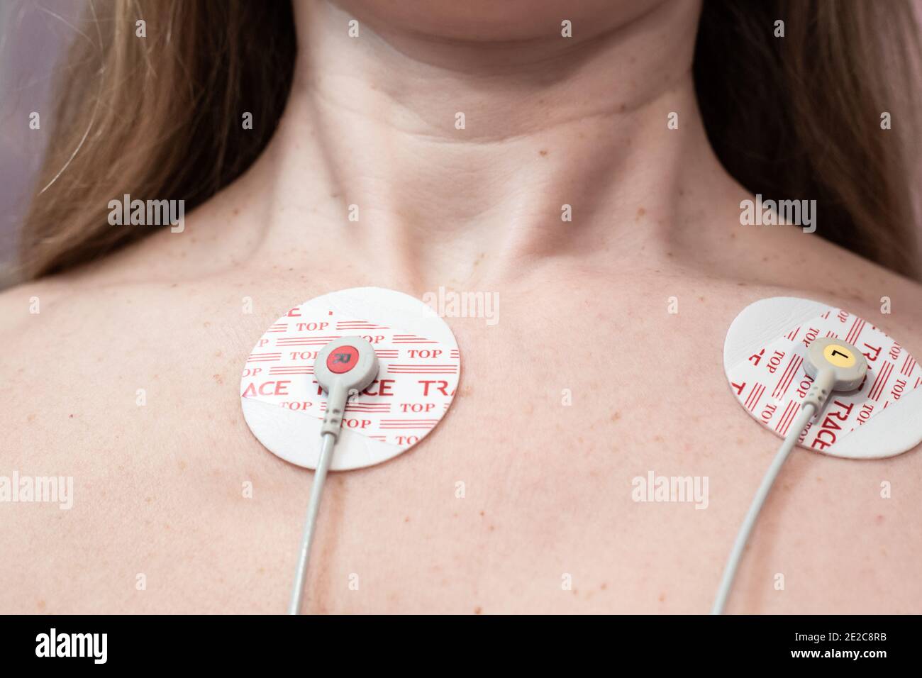 Electrodes chest hi-res stock photography and images - Alamy