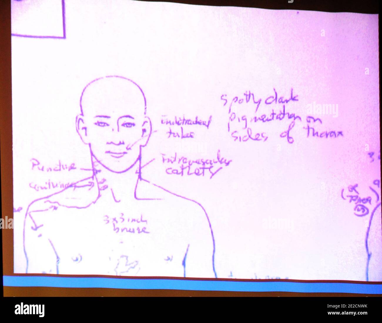 Michael Jackson Autopsy Photo Unedited