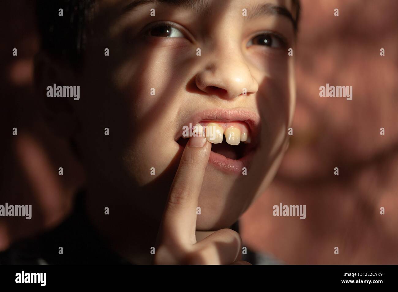 loss of a baby tooth in an eight-year-old child, at the last stage ...