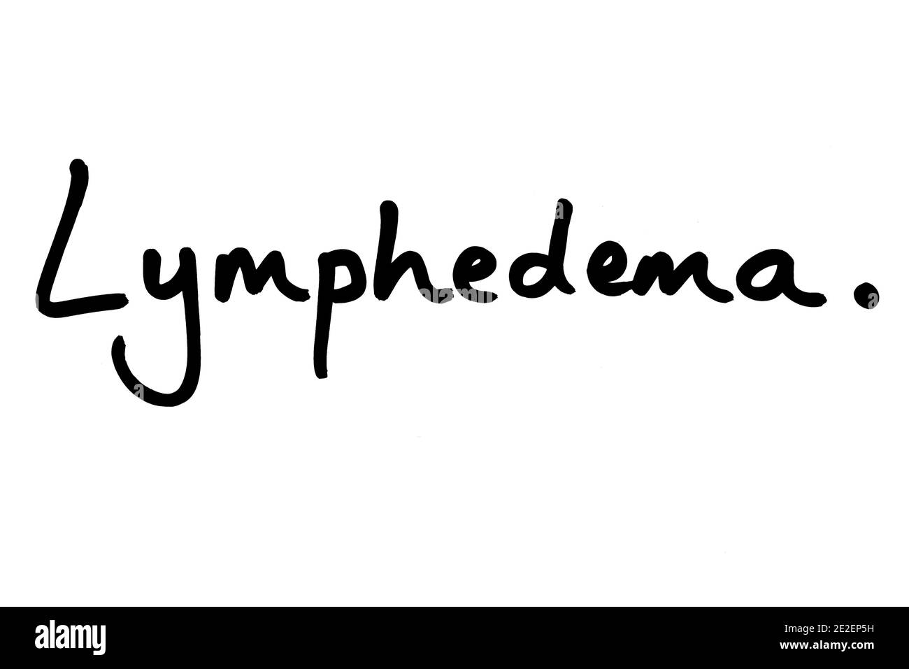 Lymphedema hi-res stock photography and images - Alamy