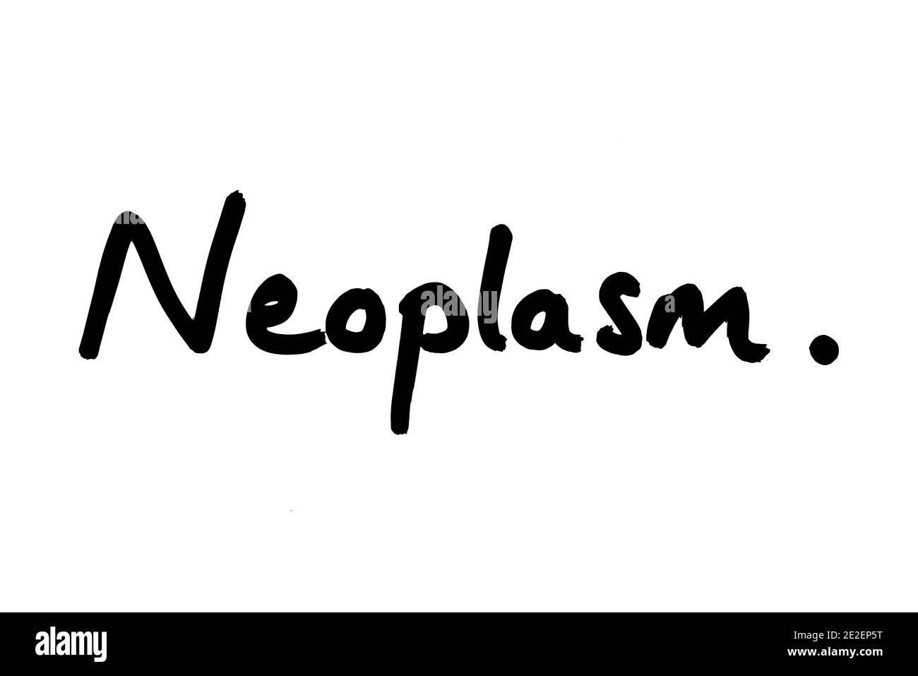 Neoplasm hi-res stock photography and images - Alamy