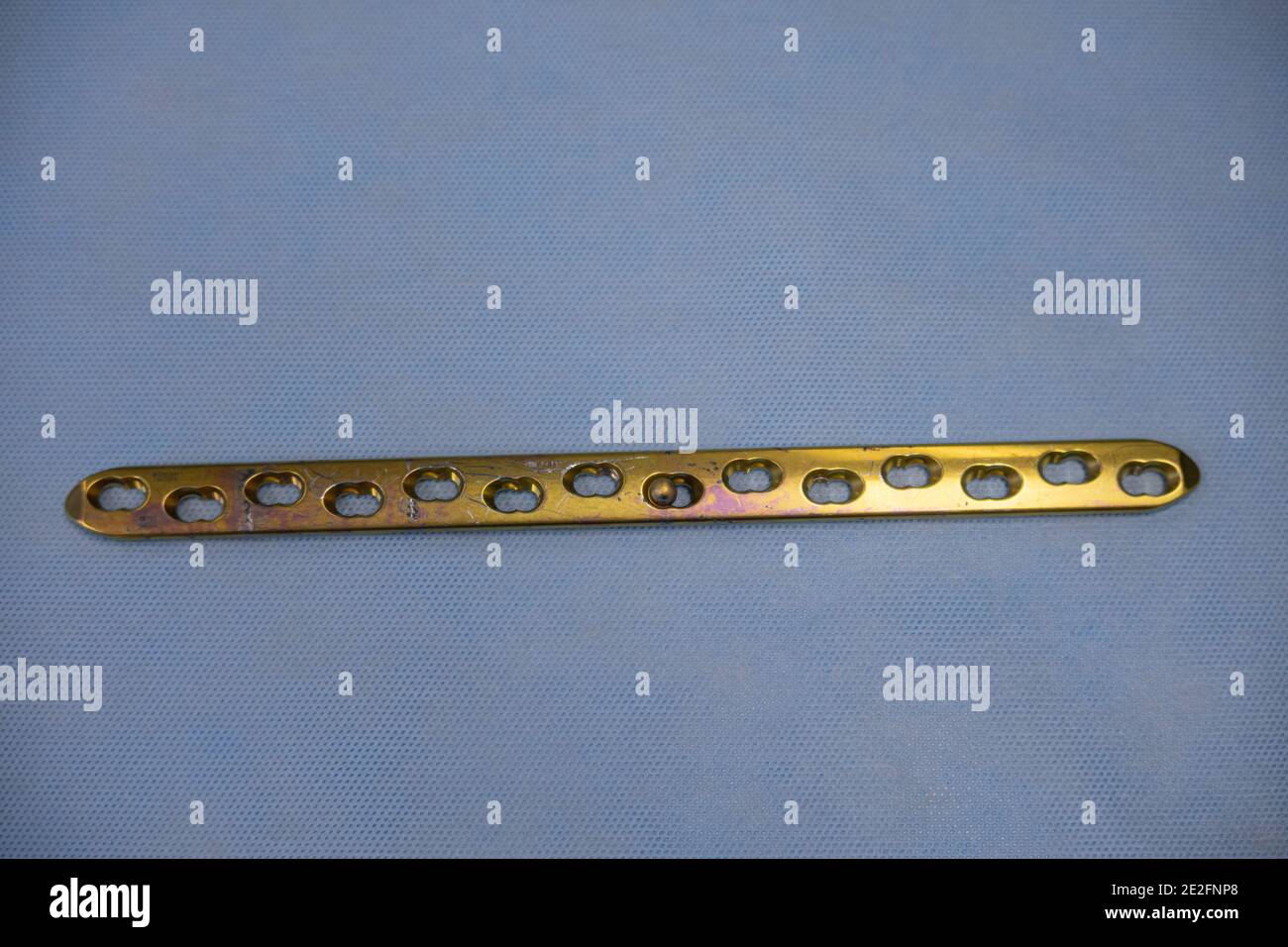 an explanted surgical gold-colored titanium plate lies on an operating ...