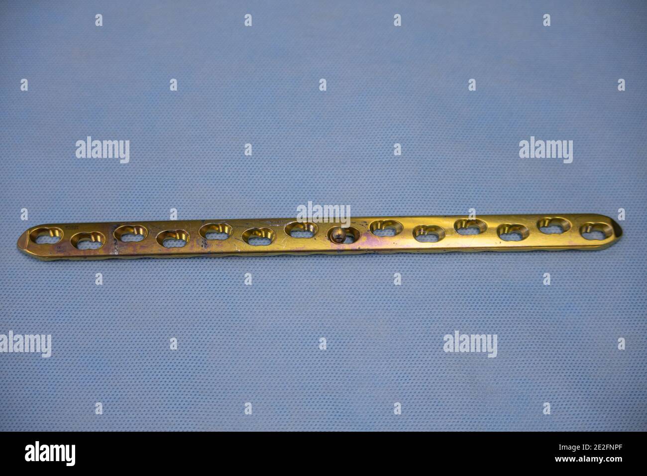 Knee joint meniscus x ray test hi-res stock photography and images - Alamy