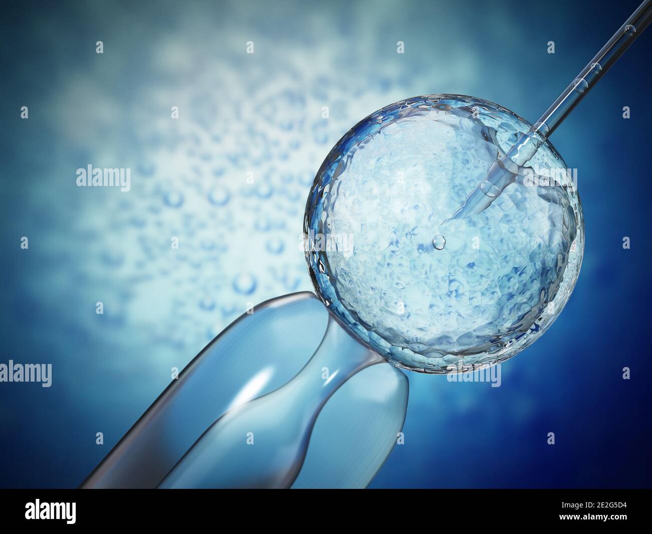 3D illustration of artificial insemination process showings sperms ...