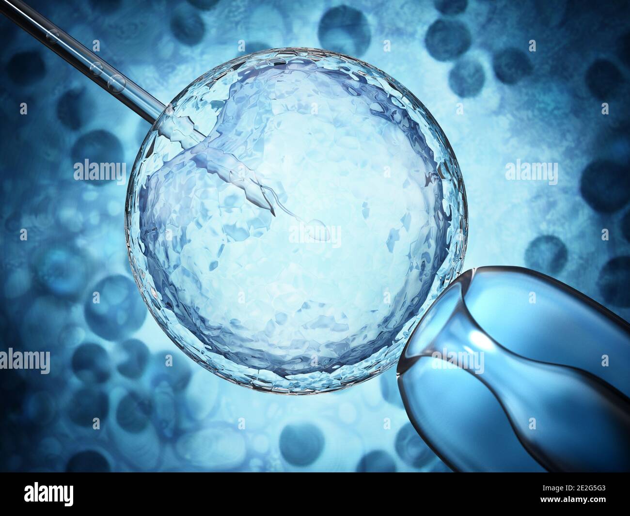 3D illustration of artificial insemination process showings sperms ...