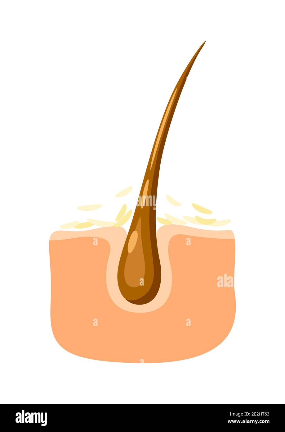 Hair follicle dandruff illustration Stock Vector Image & Art - Alamy