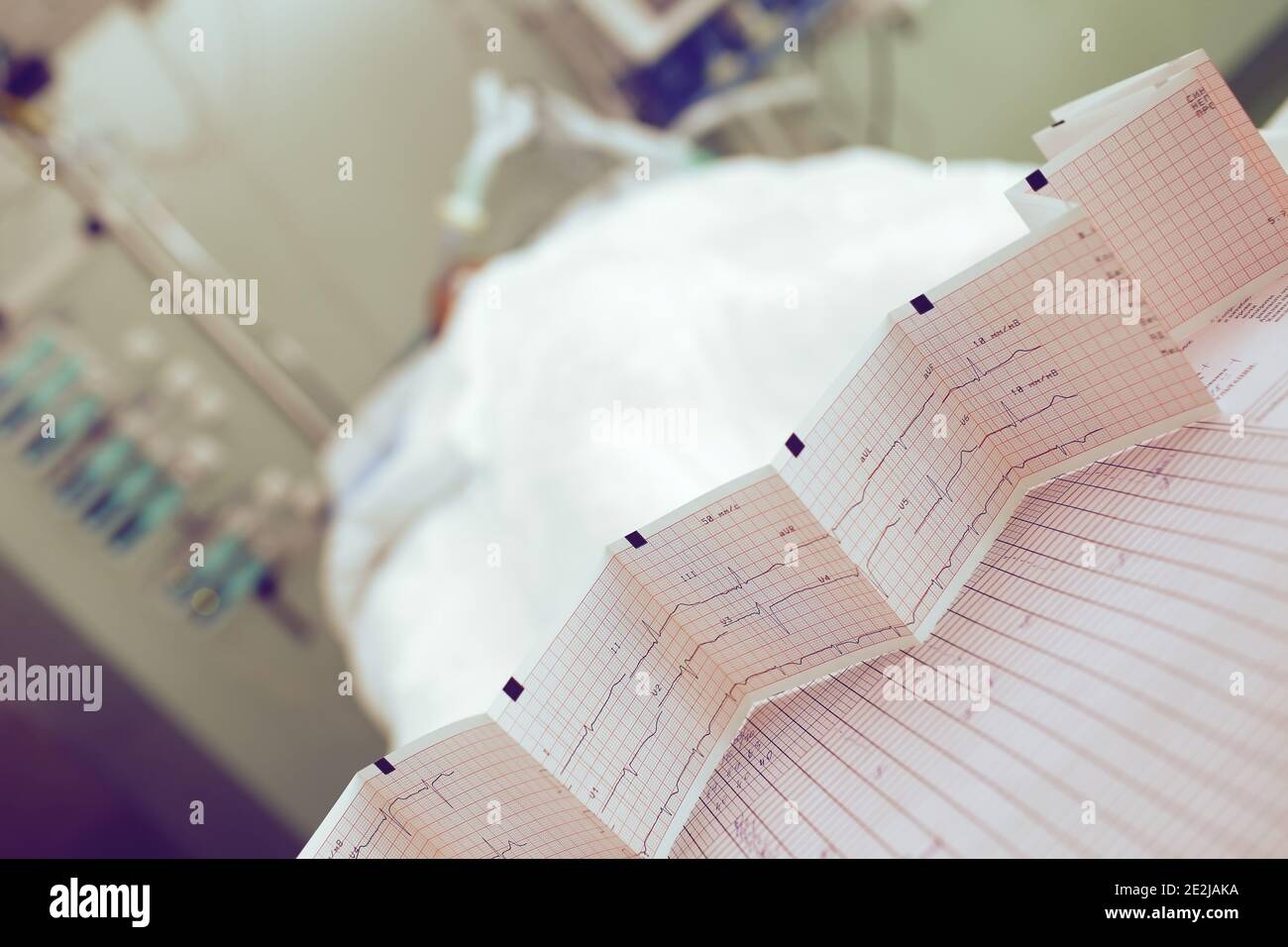 Ecg chart hi-res stock photography and images - Alamy