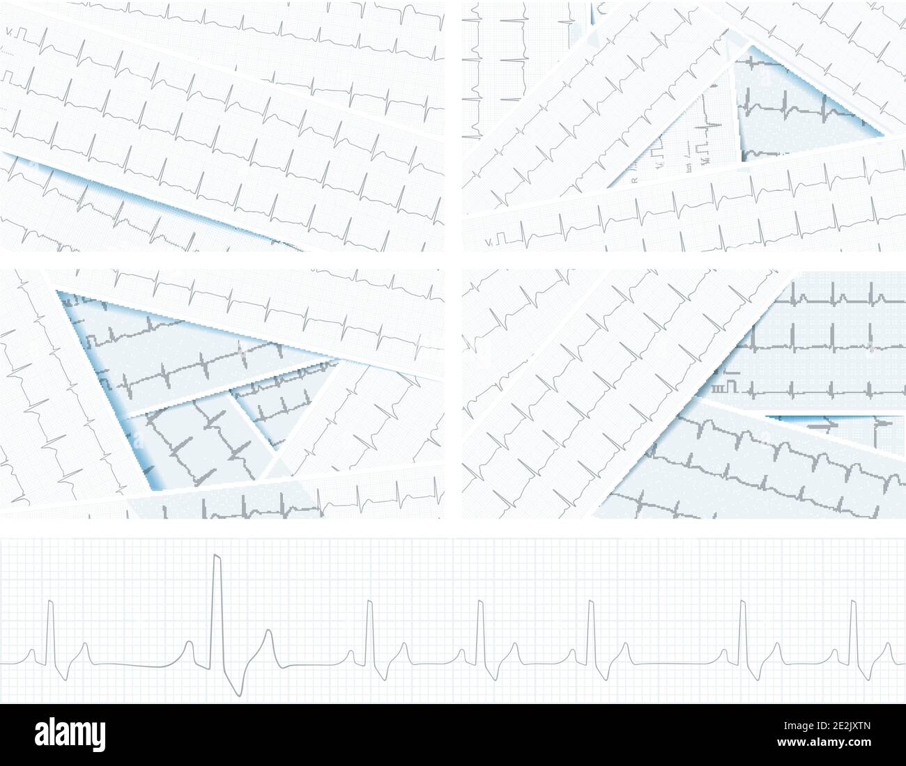 Scattered ECG charts as a healthcare background, vector Stock Vector ...