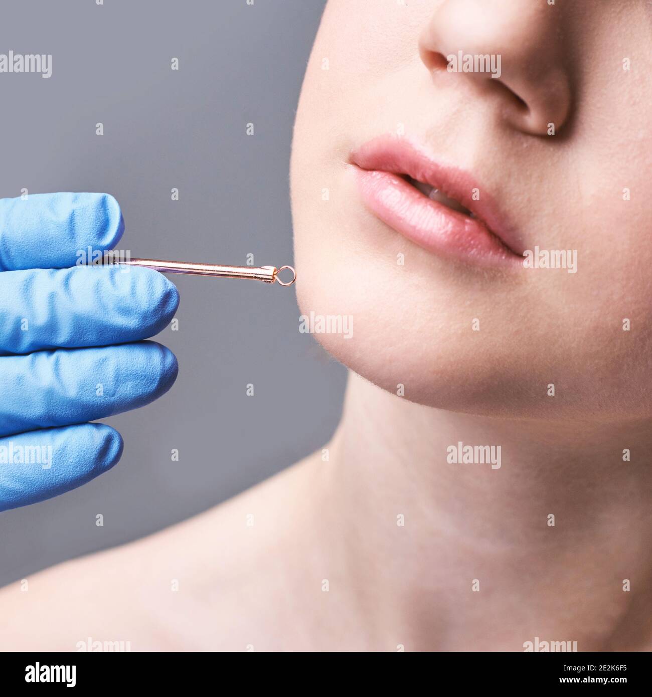 Loop device for medical design. Woman skin procedure. Natural cosmetic ...