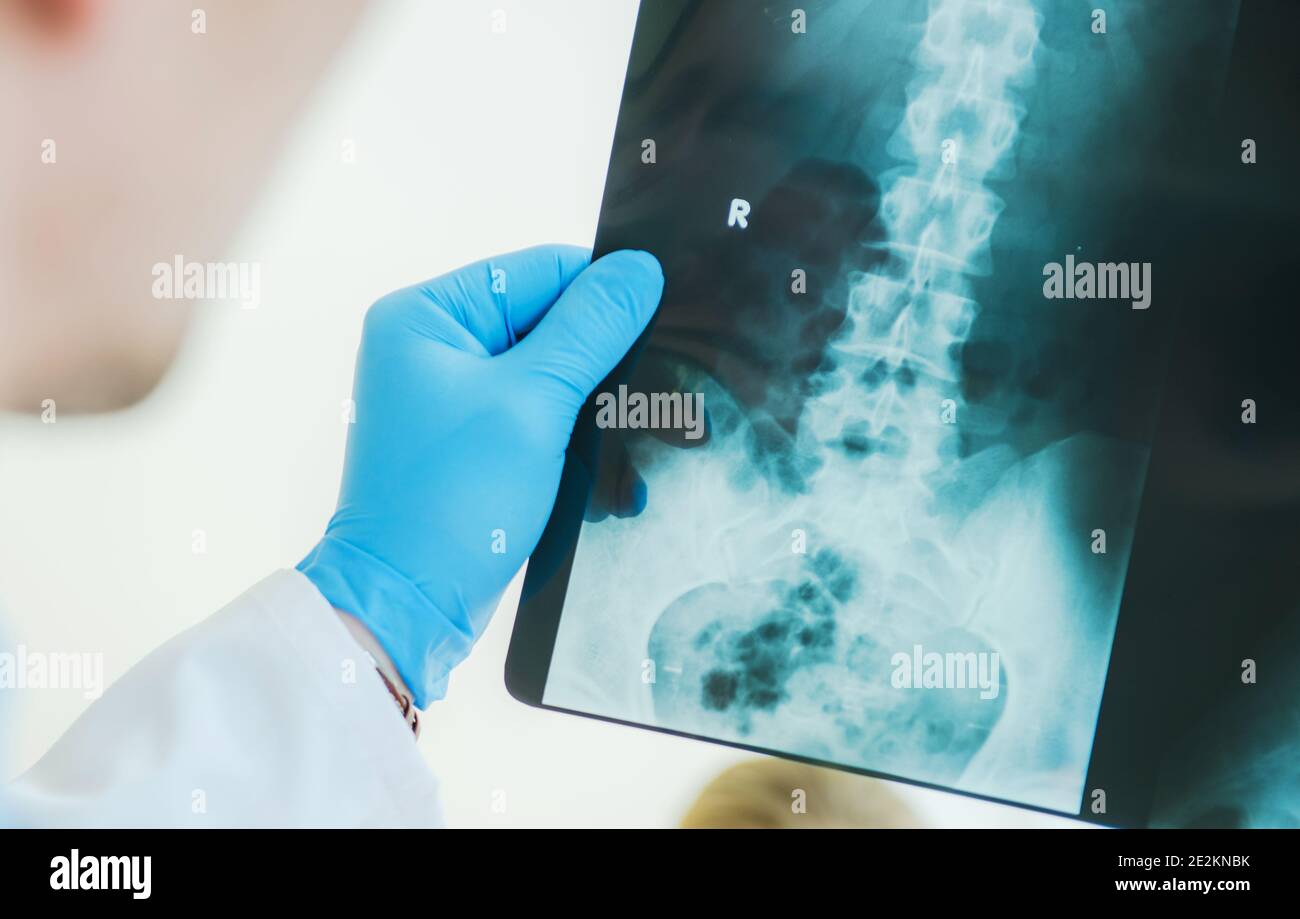 Backscatter xray hi-res stock photography and images - Alamy