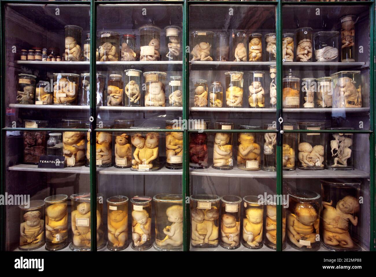 Human fetuses in formalin jars are on display in the Museum of Anatomy ...