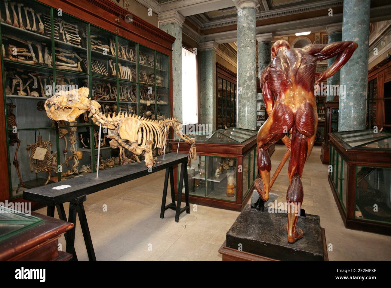 A plaster cast of a skinless body is on display in the Museum of ...