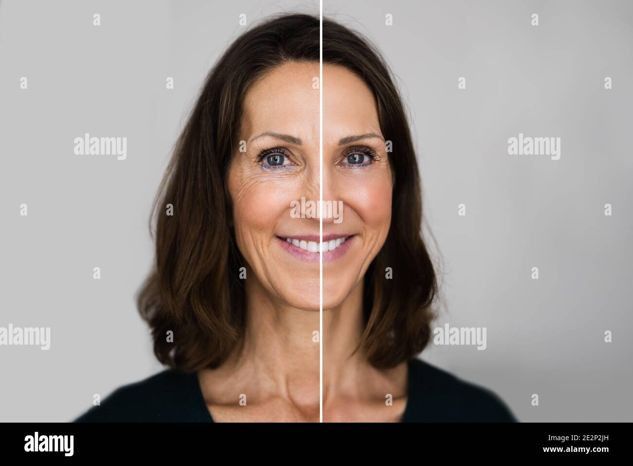 Eye rejuvenation hi-res stock photography and images - Alamy