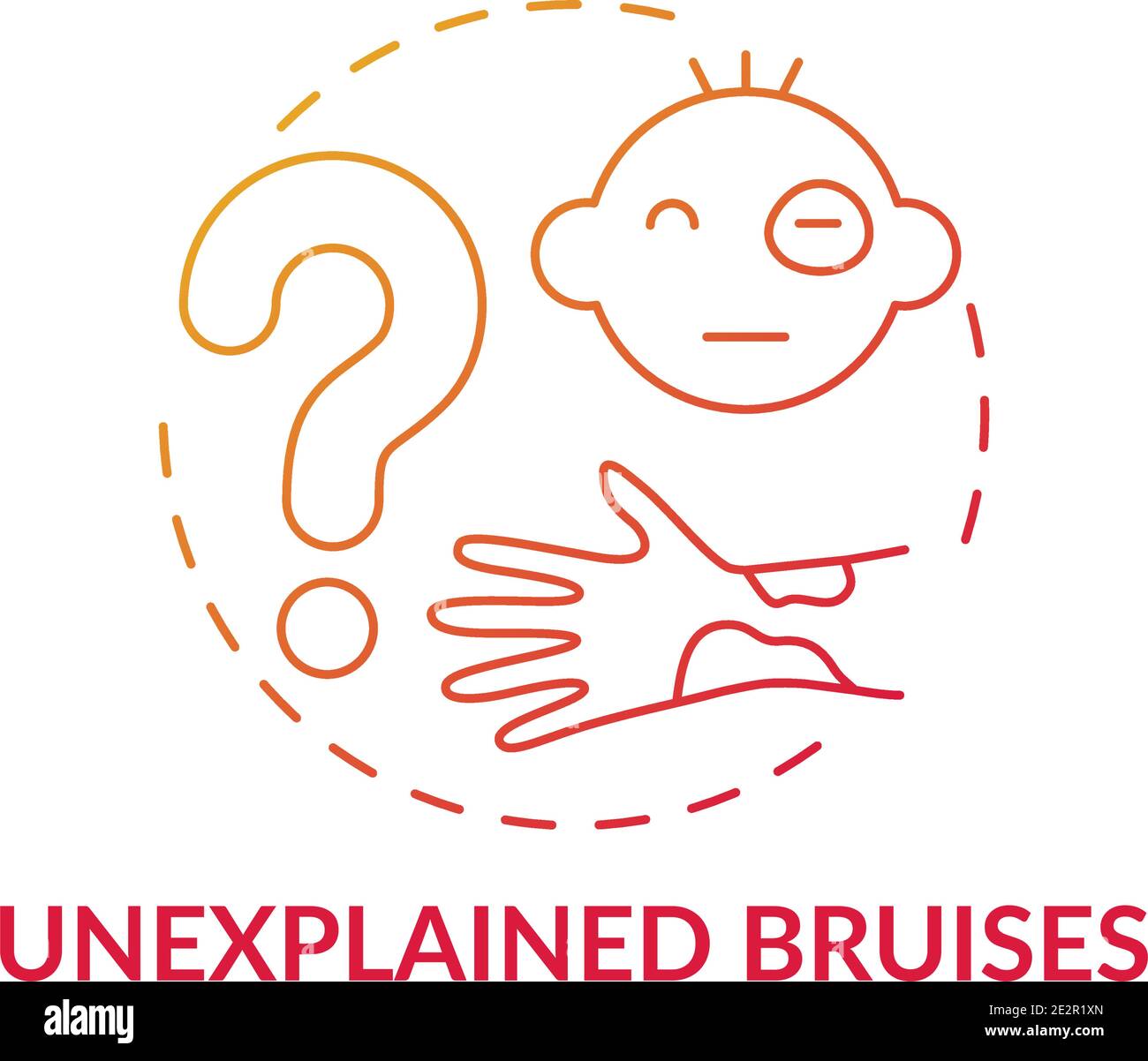 Bruise mark Stock Vector Images - Alamy