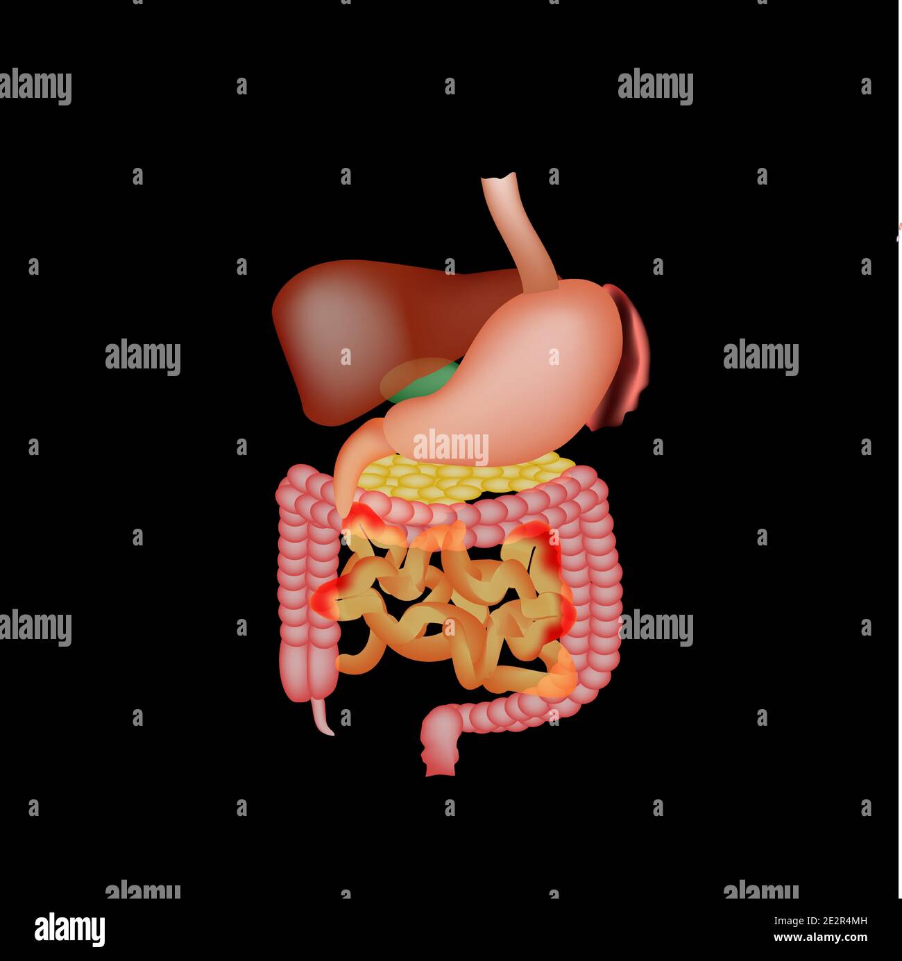 Anatomical structure of the abdominal organs. Spleen, liver ...