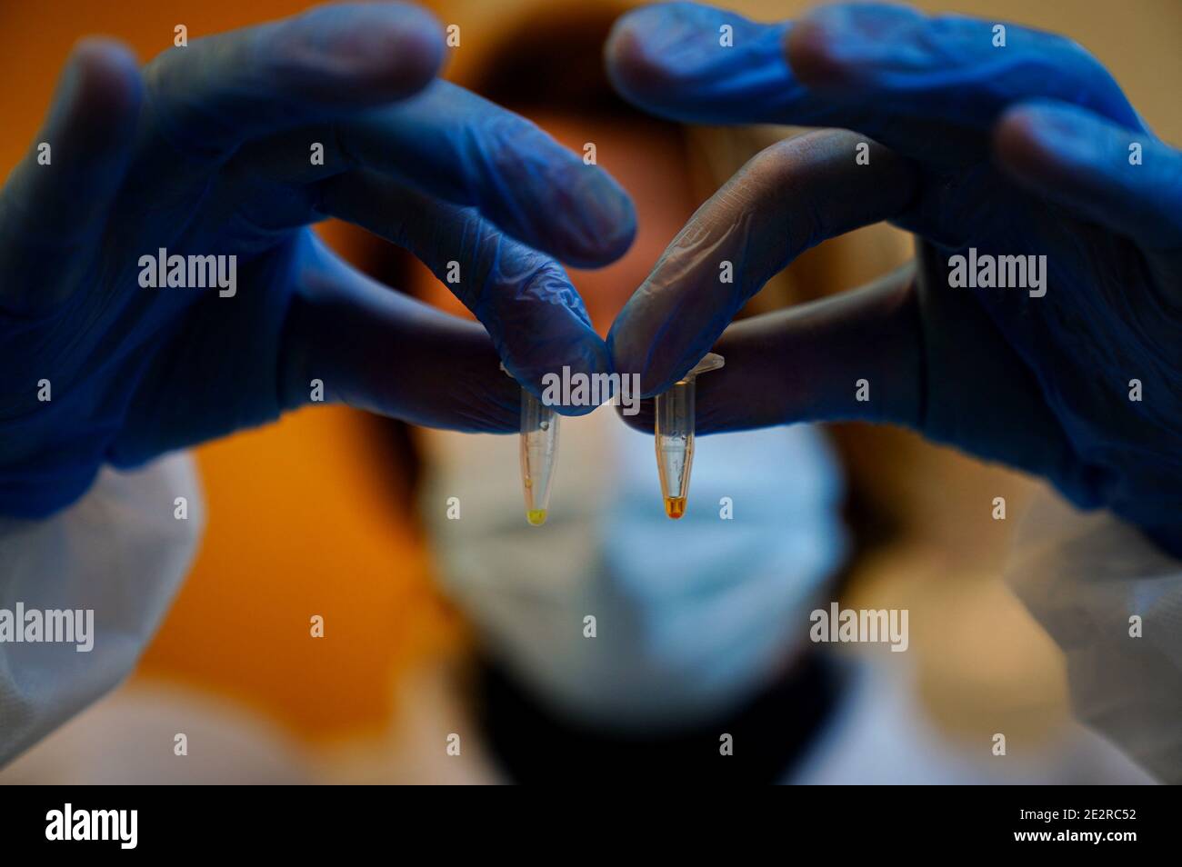 Example of a positive (yellow) and negative (orange) result of an ...
