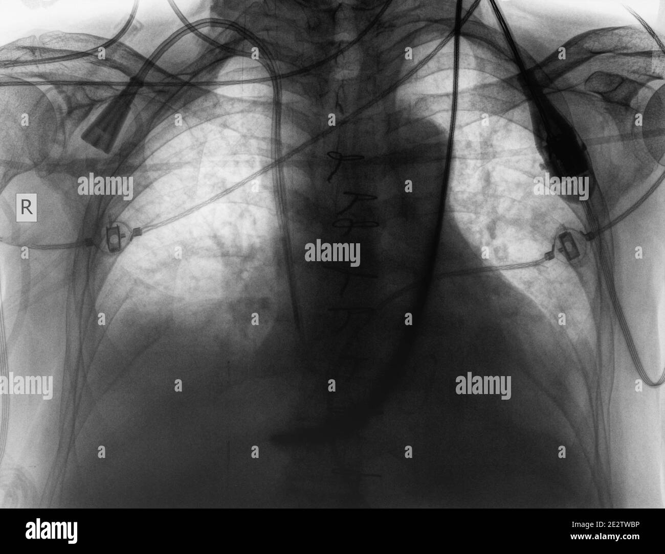 X-ray as a medical background Stock Photo - Alamy