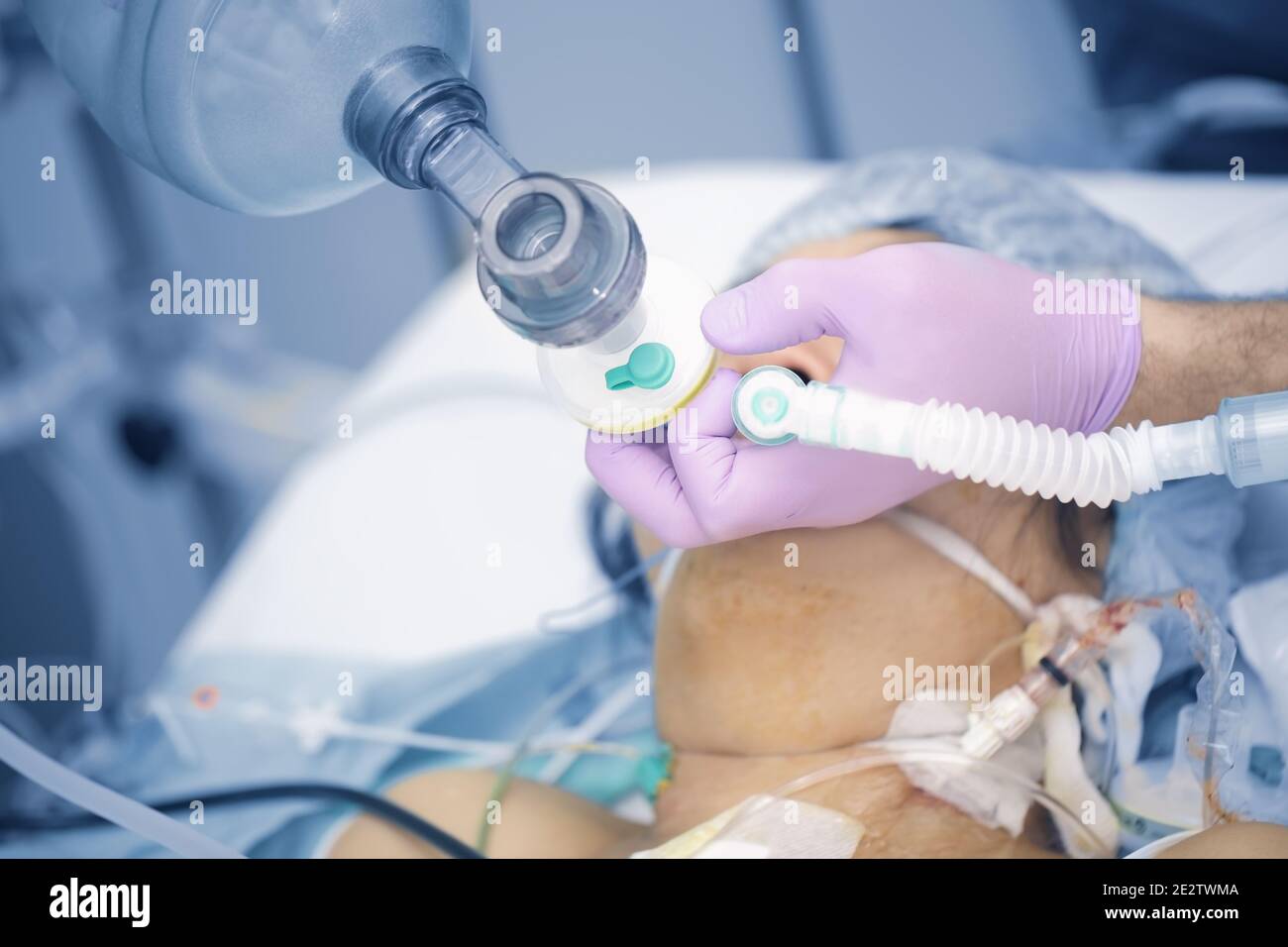 Manipulation with the respiratory system of a severe patient Stock ...