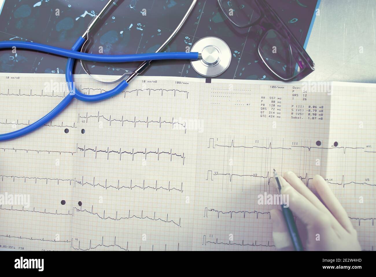 Ecg scan hi-res stock photography and images - Alamy