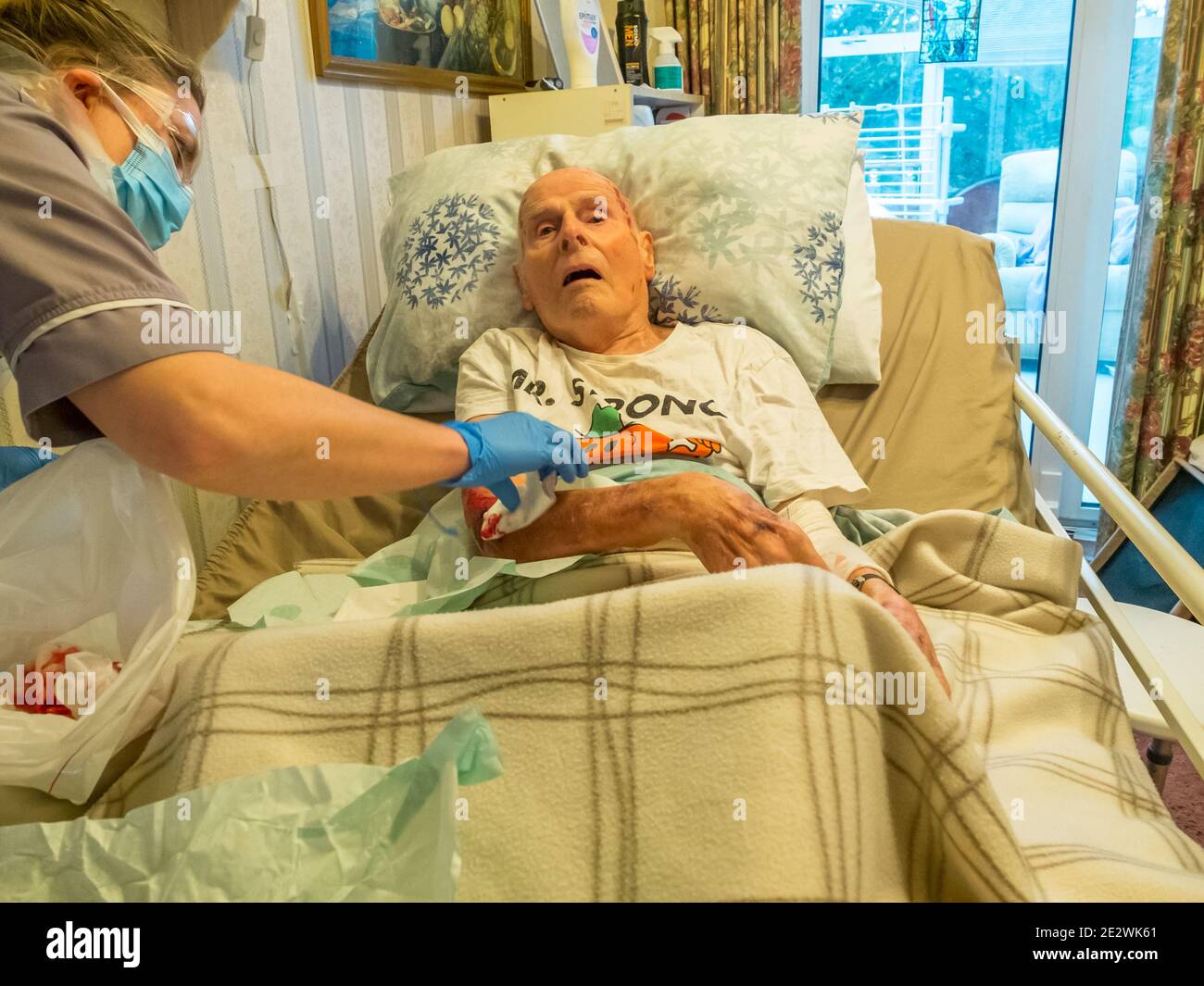 Accident Arm Bleeding Blood Bloody High Resolution Stock Photography ...