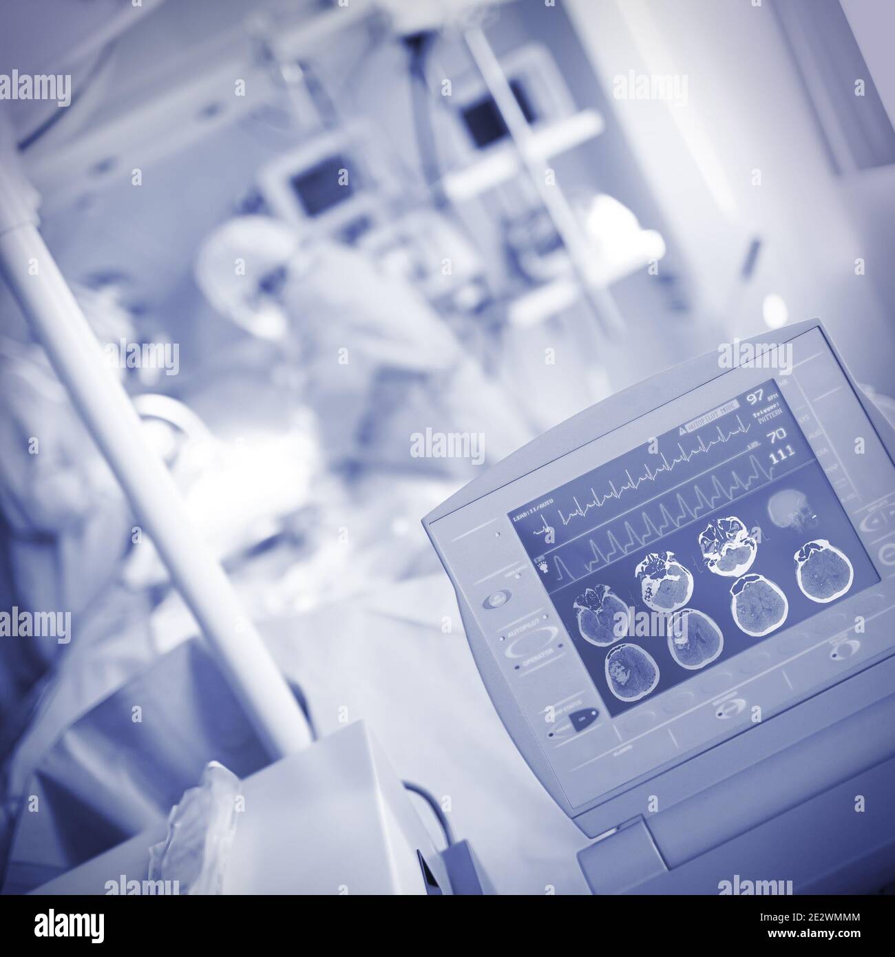 Monitoring of patient`s condition in the operating room Stock Photo - Alamy