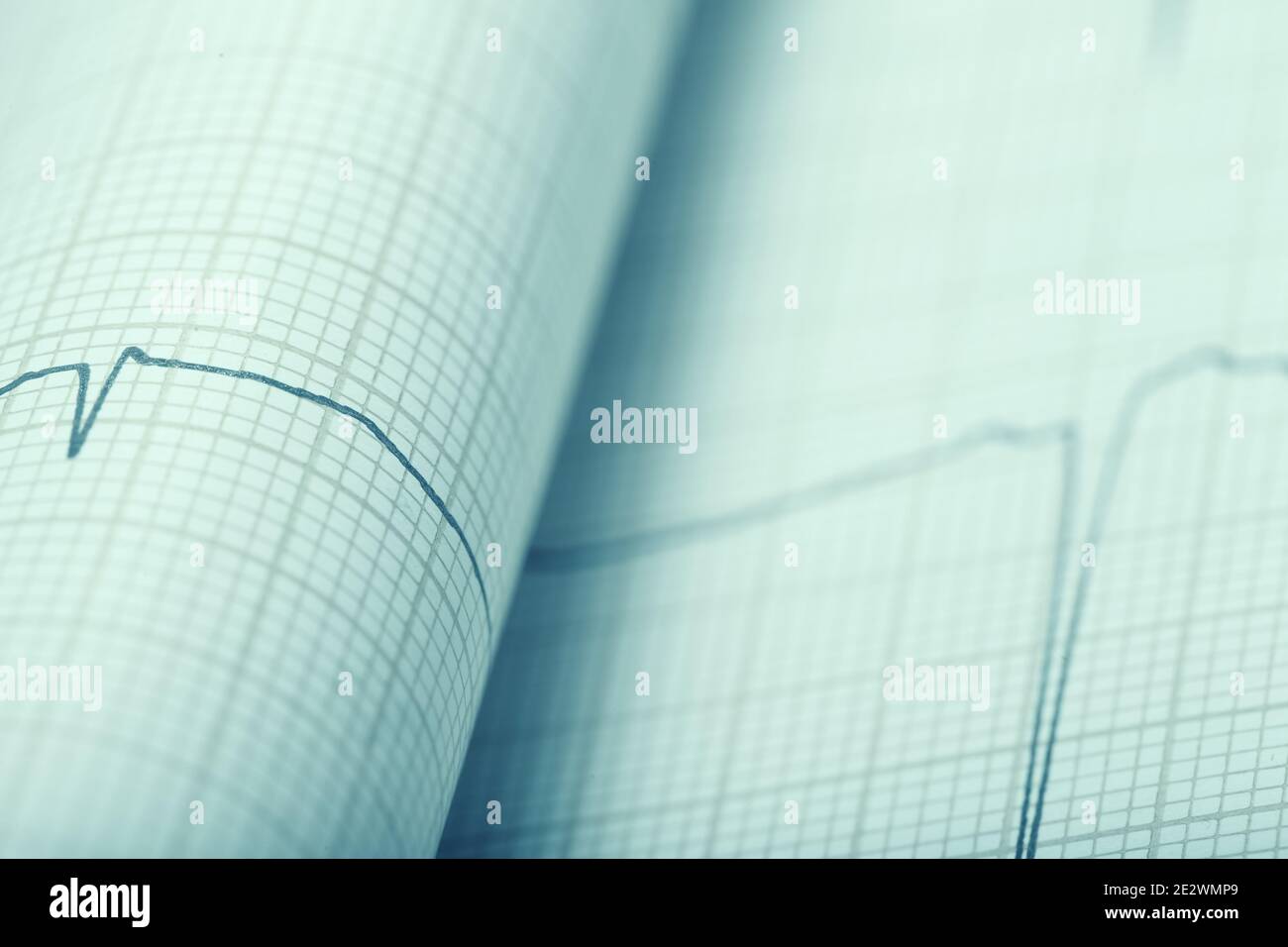 Medical record of patient ECG Stock Photo - Alamy