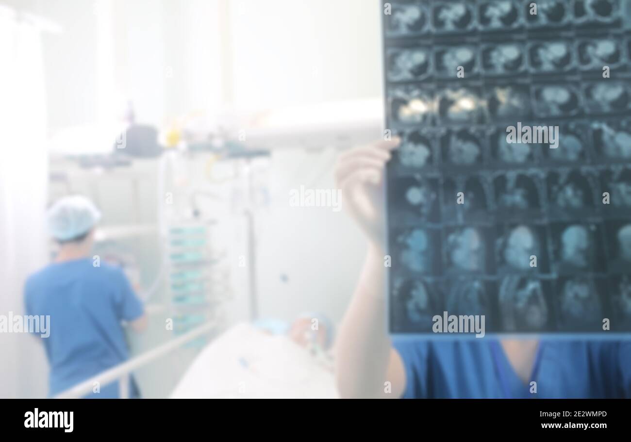 Looking on the result of MRI scanning, blurred background Stock Photo ...