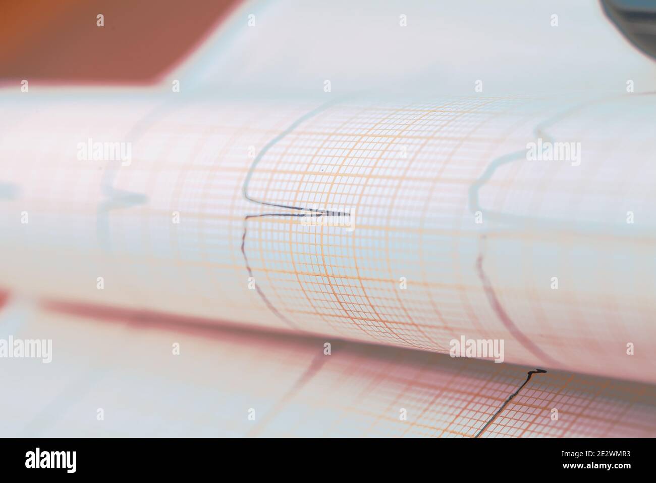 Ecg chart hi-res stock photography and images - Alamy