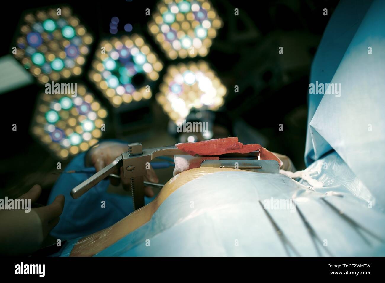 Unusual surgical operation hi-res stock photography and images - Alamy