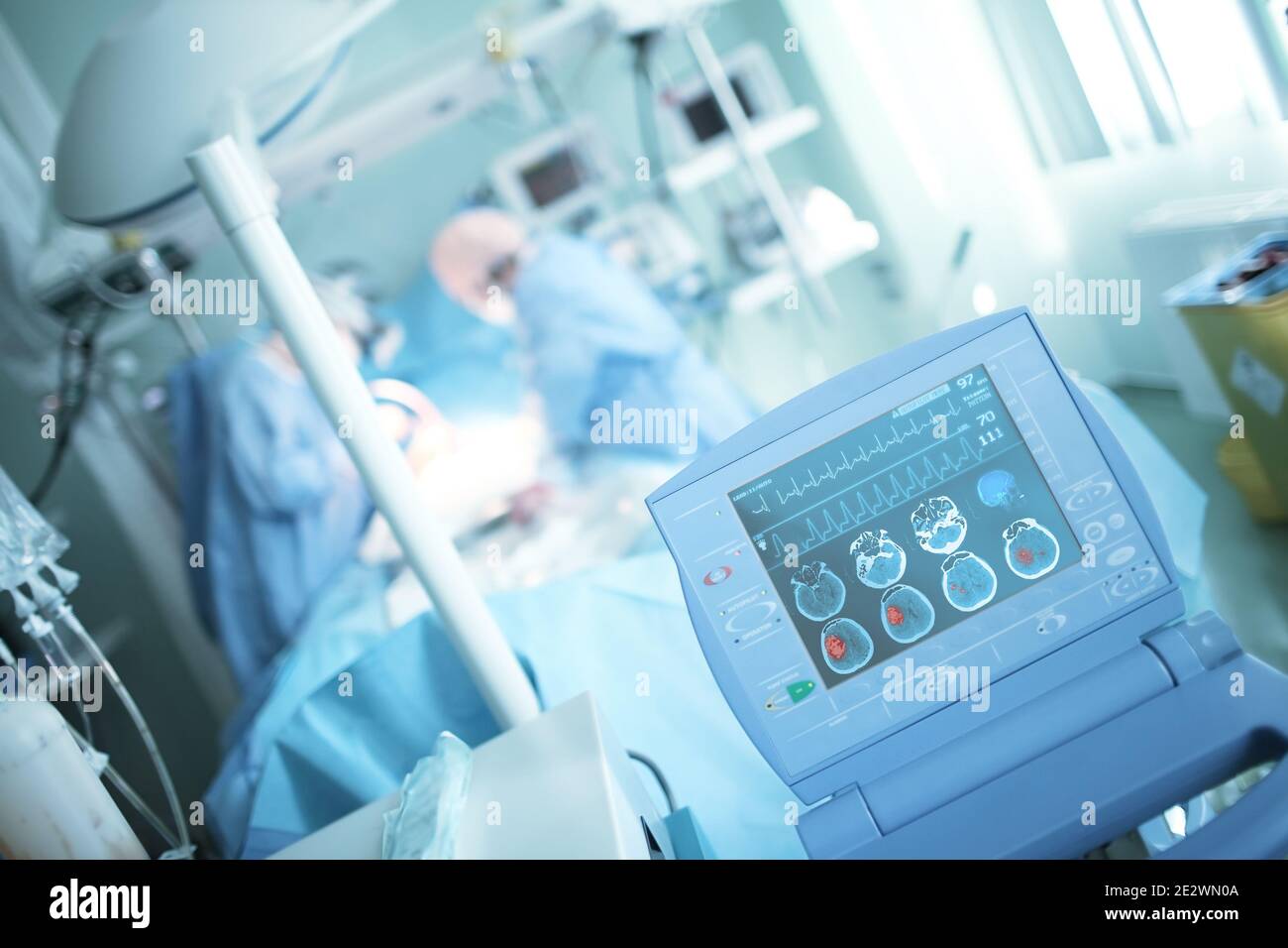 Scanning of brain damage in the ICU Stock Photo - Alamy