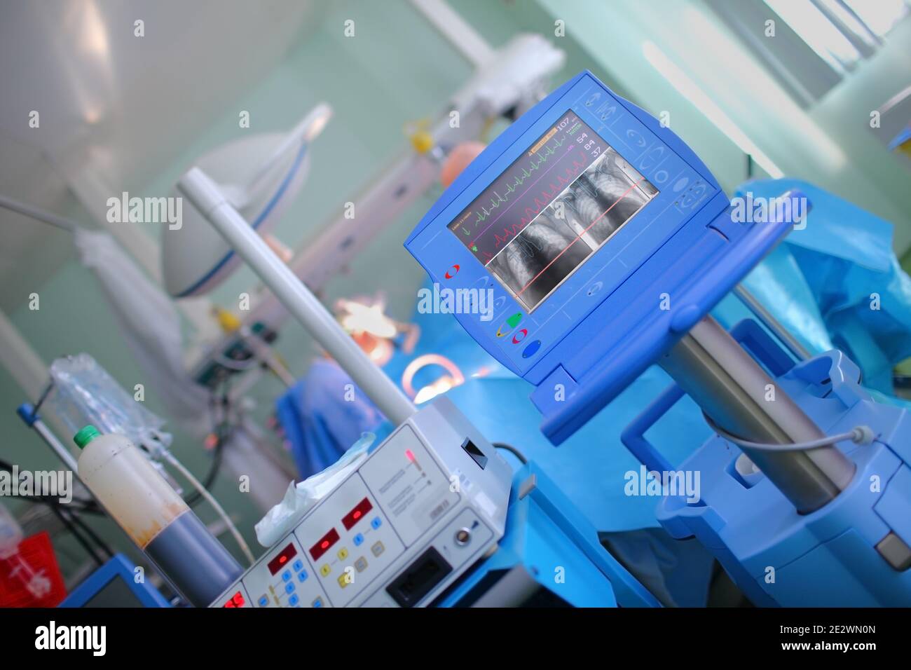 Modern technologies monitoring of the patient's condition during ...