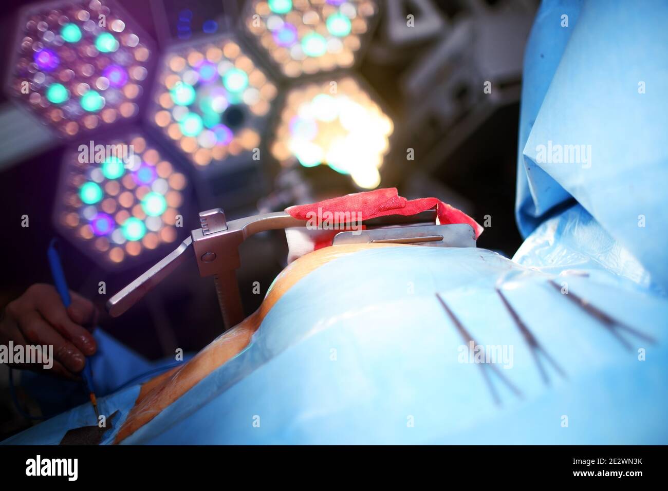 Surgery table hi-res stock photography and images - Alamy