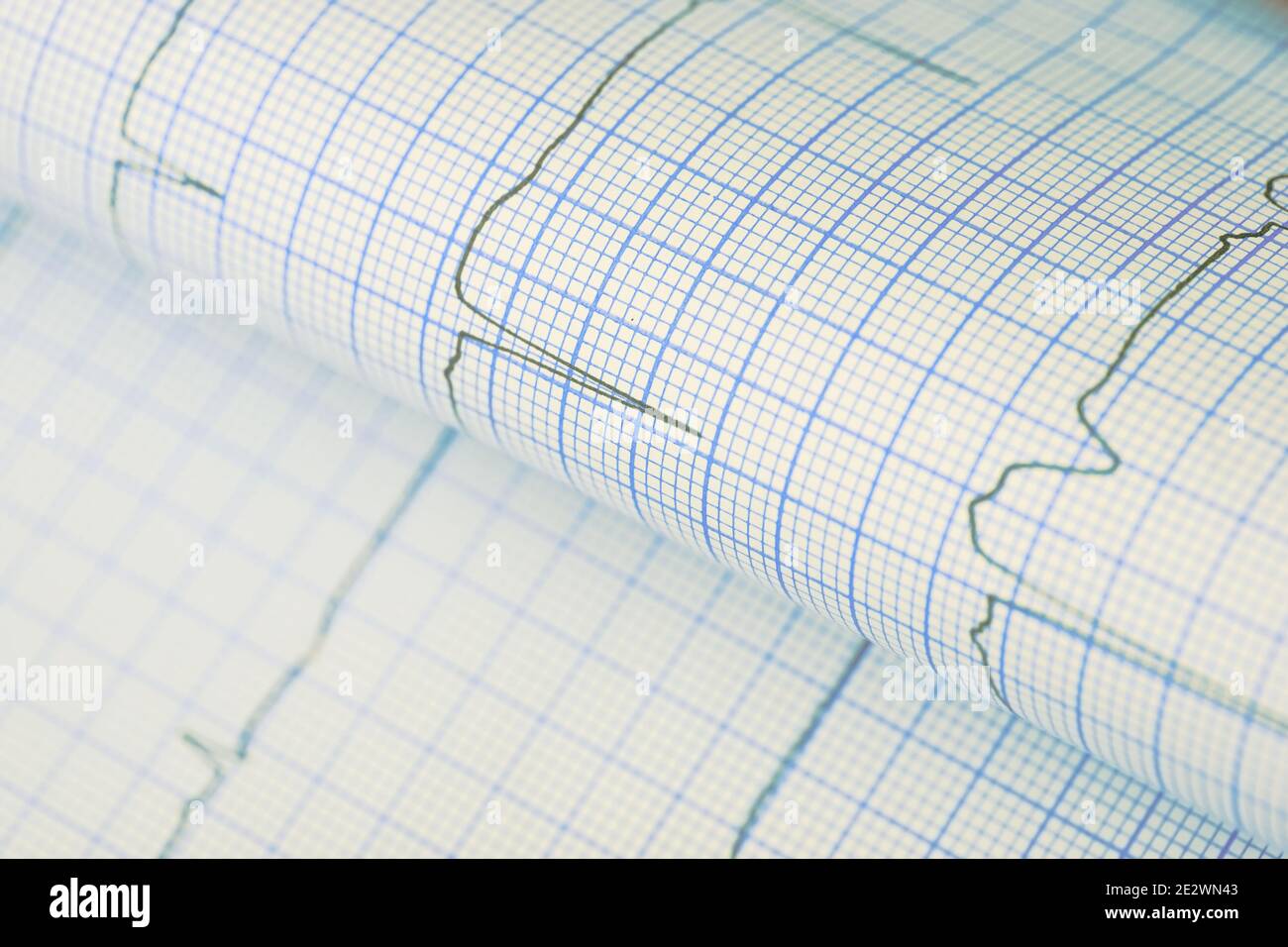 Bended ECG chart as a medical background Stock Photo - Alamy