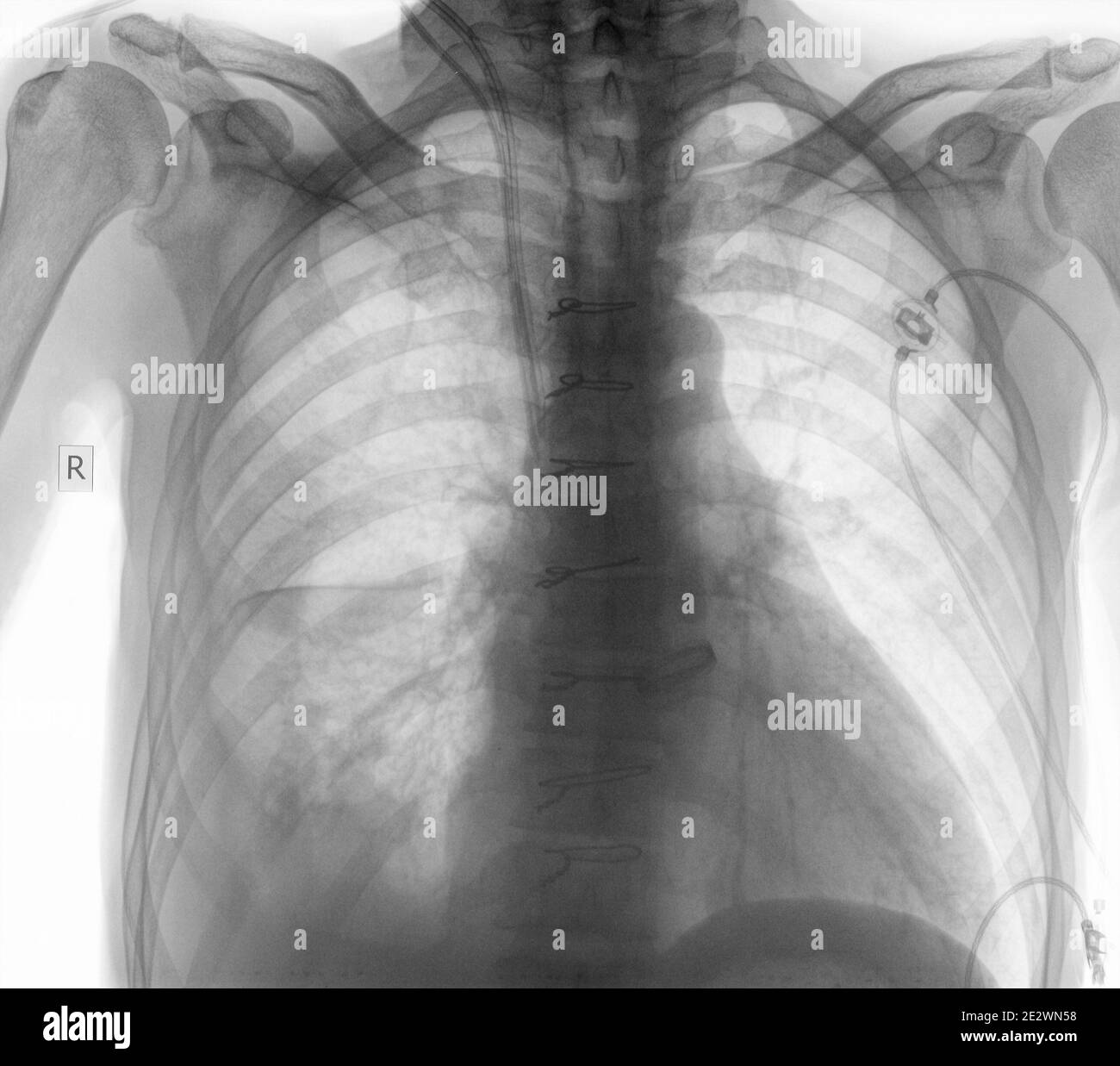 Scientific study aid Black and White Stock Photos & Images - Alamy