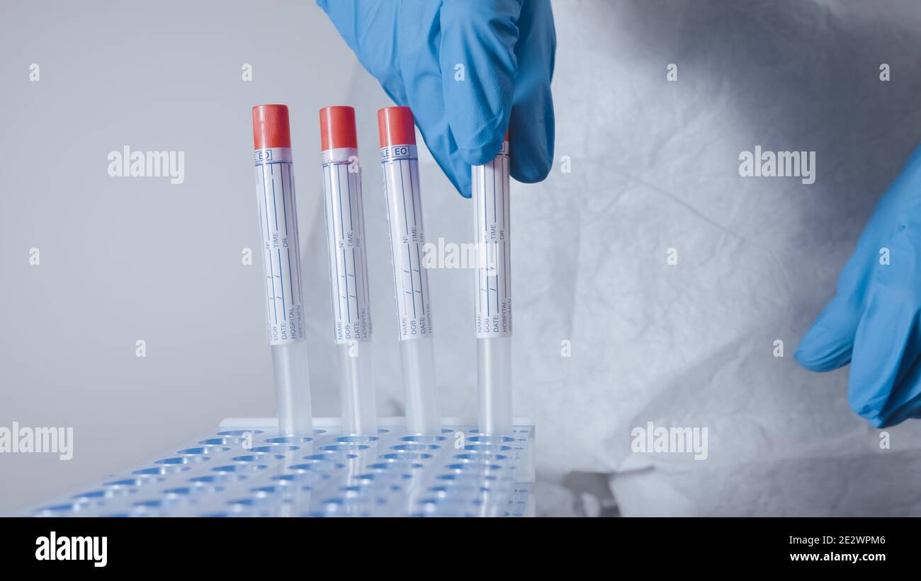 Nurse with Coronavirus PCR swab tests in a laboratory at hospital Stock ...