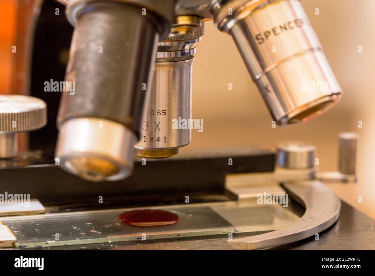 Analysis of tests under a microscope, medical research, blood analysis ...