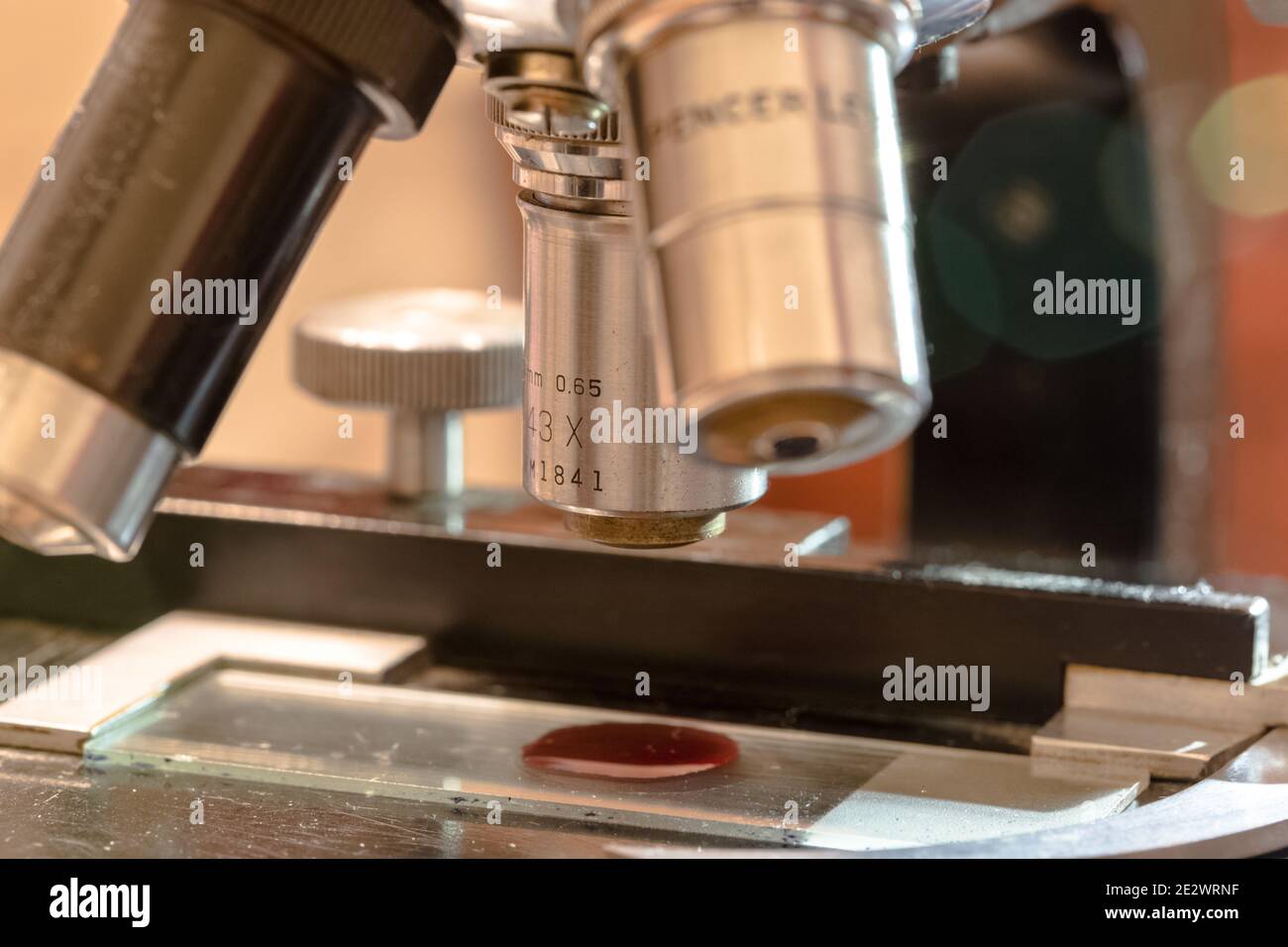 Analysis of tests under a microscope, medical research, blood analysis ...