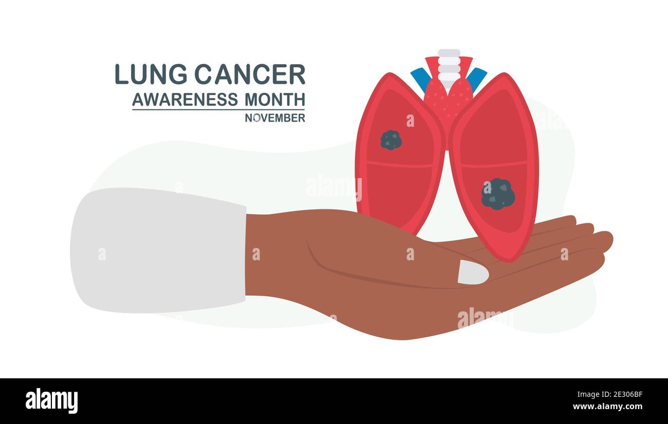 Died of lung cancer Stock Vector Images - Alamy