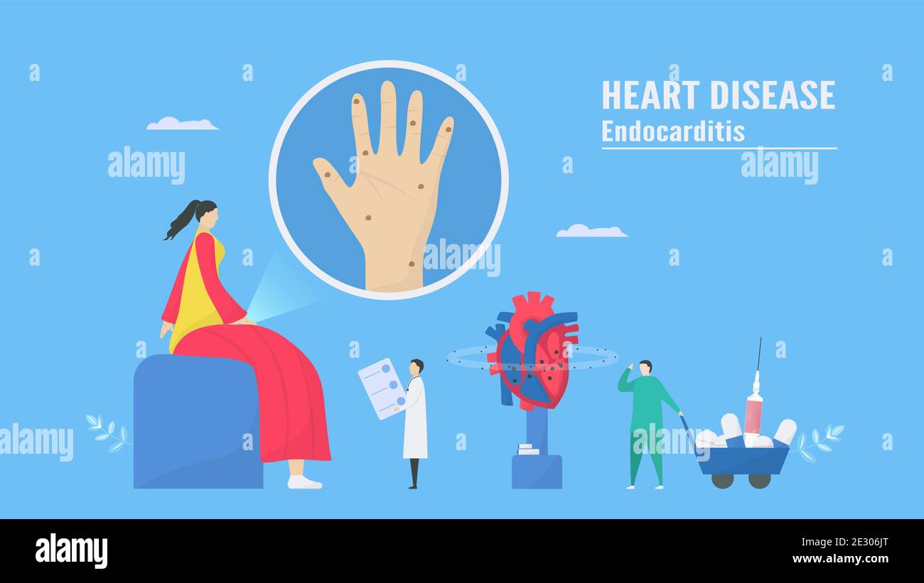 Cardiology Vector Illustration This Disease Calls Endocarditis It Is