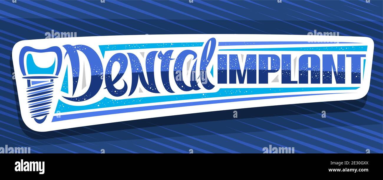 Vector banner for Dental Implant Clinic, art design decorative sign ...