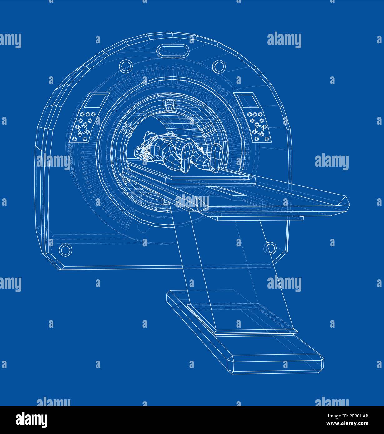 Female Patient Lying on a CT or MRI Scan. Vector Stock Vector Image ...