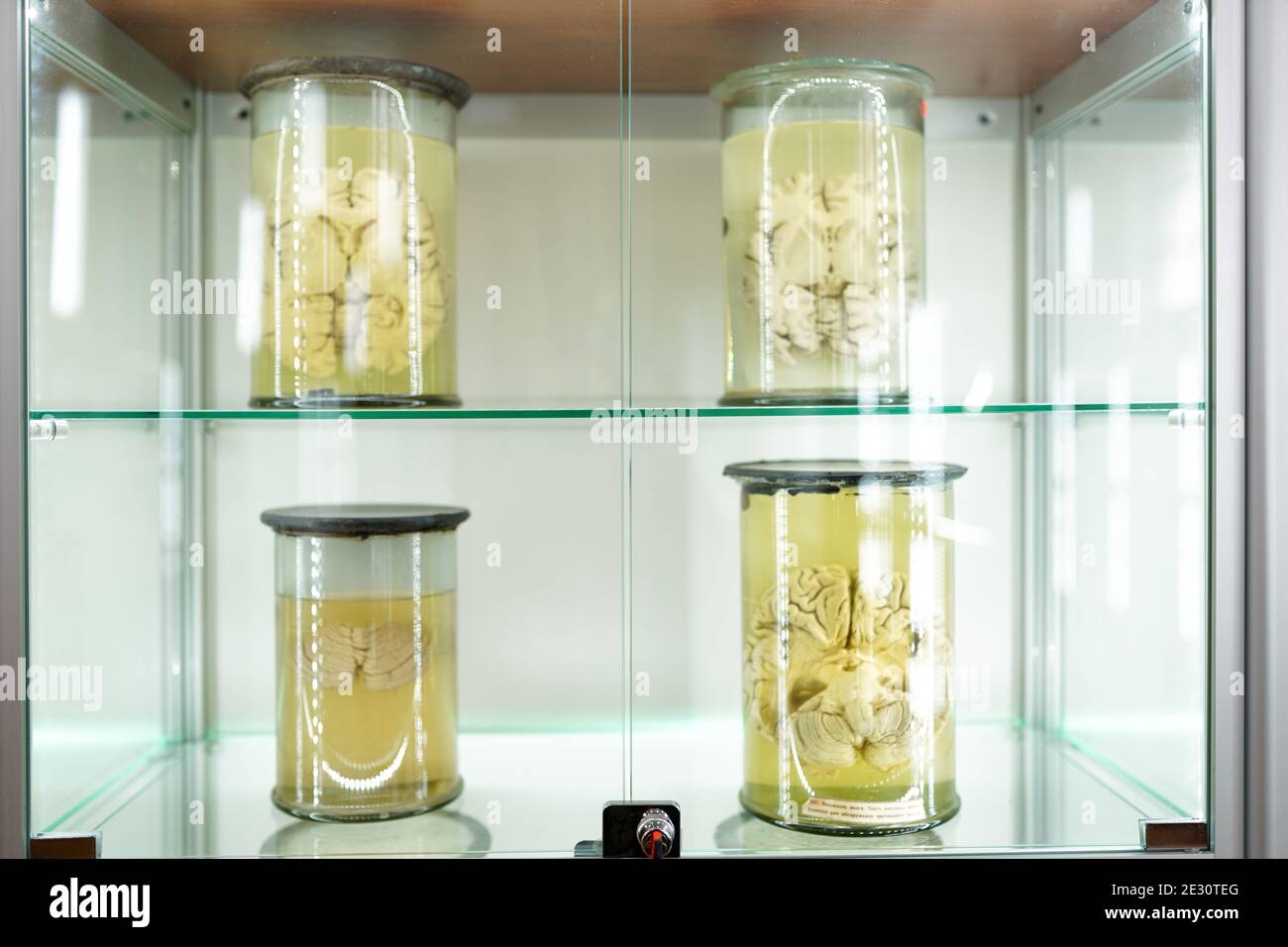 Brain in jar of formaldehyde hi-res stock photography and images - Alamy