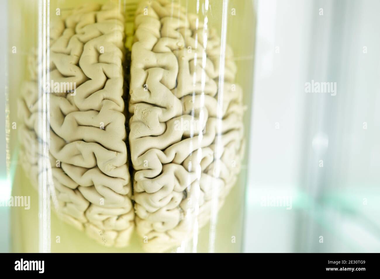 Human organ brain Anatomy. part of the human body in formalin. Medical ...
