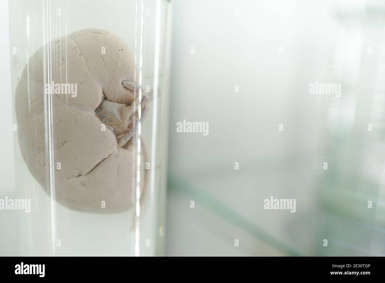 Human organ Anatomy. kidney part of the human body in formalin. Medical ...